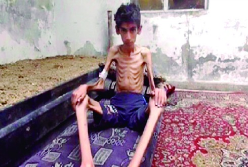 Alerta la ONU por muertes por inanición - El Diario NTR | NTR Guadalajara